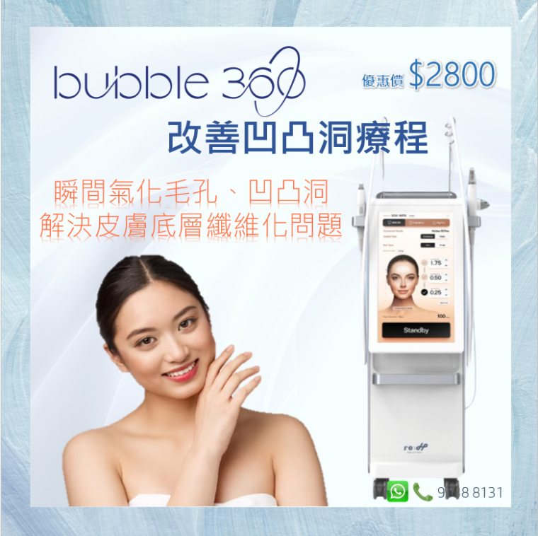 Bubble 360改善凹凸洞療程 | 熨平凹凸洞只需$2800