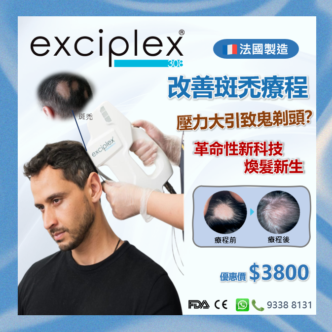 Exciplex®-Excimer Laser | 鬼剃頭打擊自信？只需$3800即可改善