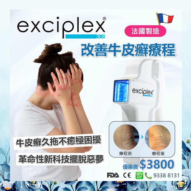Exciplex®-Excimer Laser | 革命性新科技改善牛皮癬問題 只需$3800