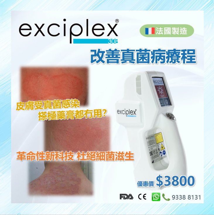 Exciplex®-Excimer Laser | 皮膚受真菌感染難斷尾 $3800即可抑制細菌增長